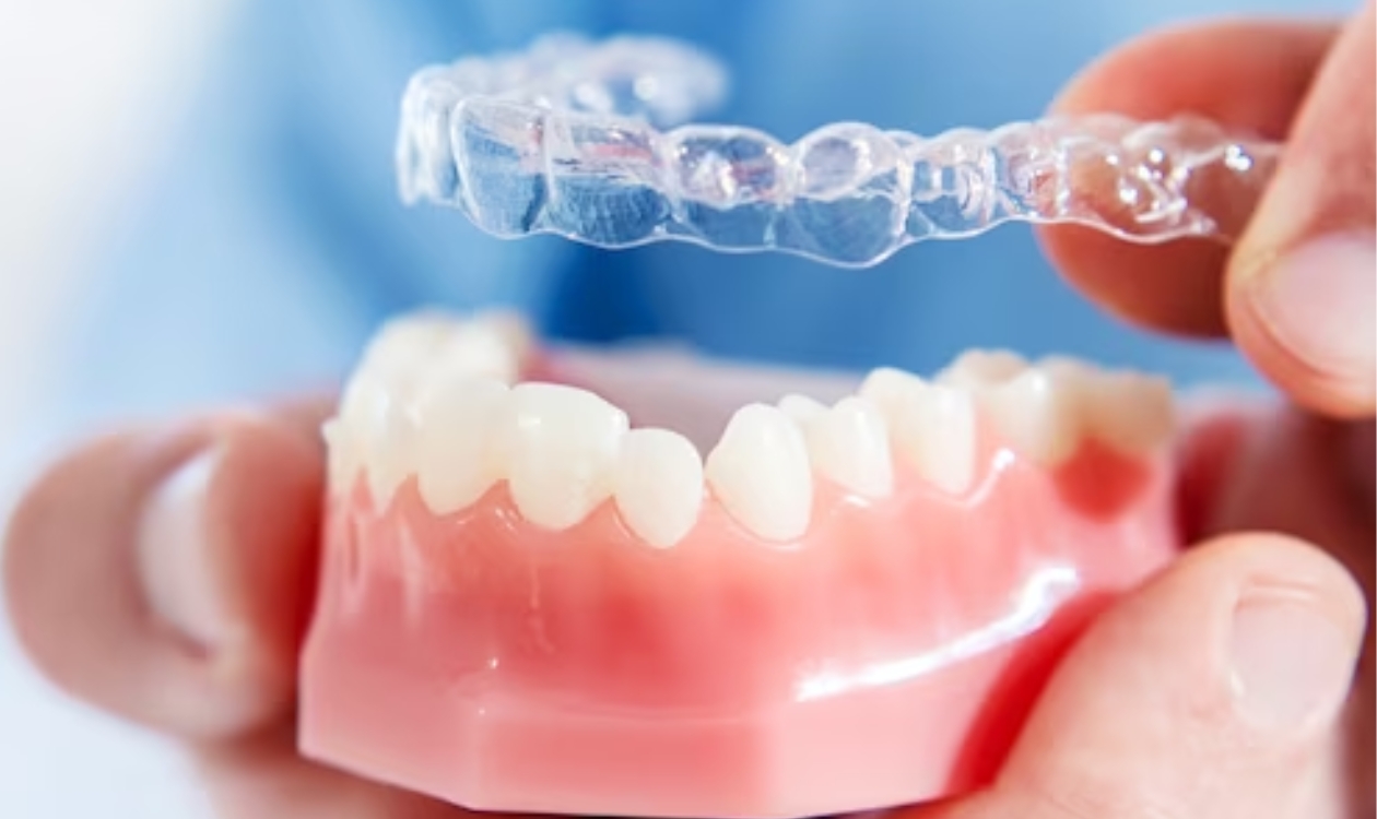 Does Invisalign Straighten Your Teeth Faster Than Braces